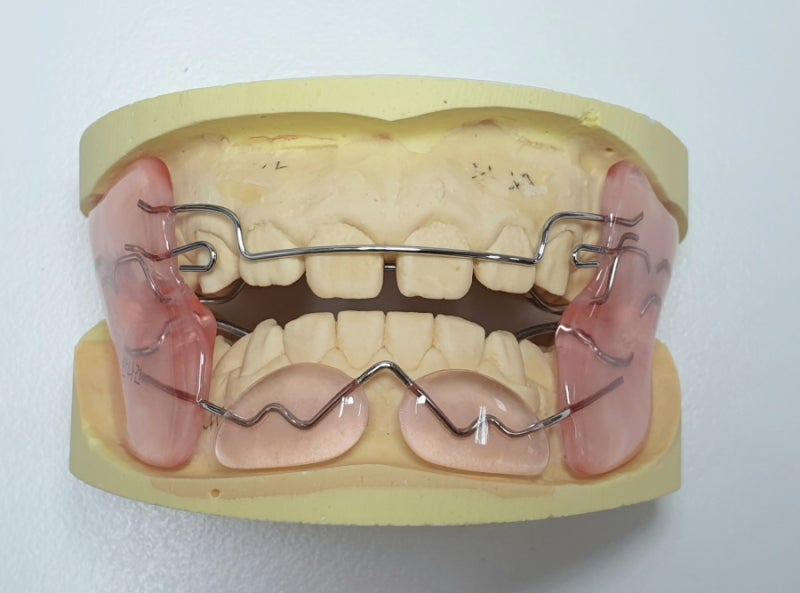 Frankel appliance/Function Regulator : 네이버 블로그