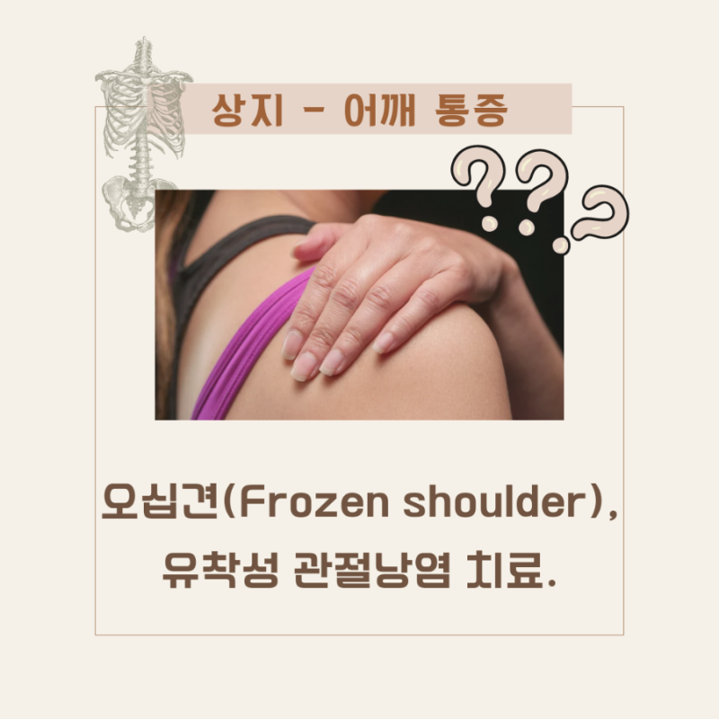 오십견 유착성 관절낭염의 치료 방법은 물리치료 스트레칭 스테로이드 관절강 내 주사 신경 차단술까지 네이버 블로그
