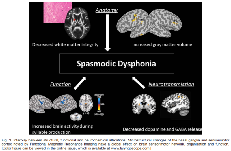 음성장애 (1) - 연축성 발성장애(spasmodic dysphonia) : 네이버 블로그