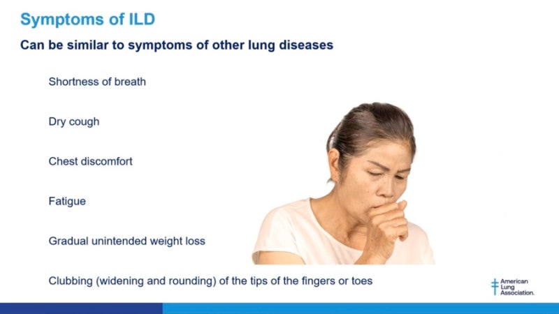의학용어 ILD (Interstitial Lung Disease) 간질성 폐질환 공부하기 : 네이버 블로그