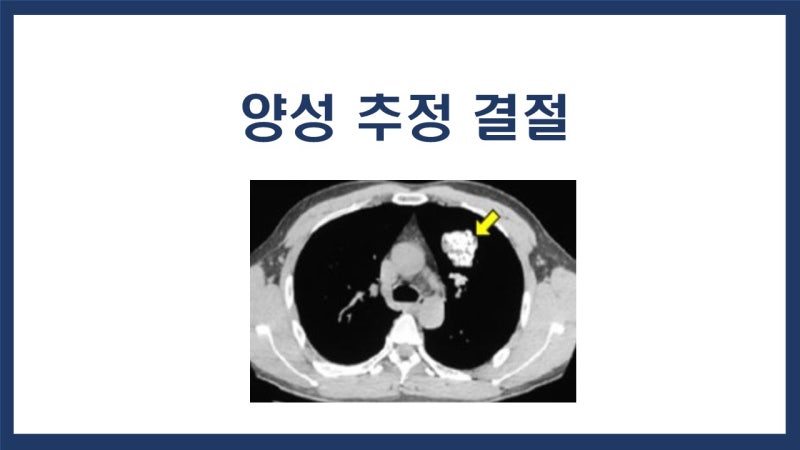 폐암 검사 결과 간유리 음영 결절 고립성 폐결절 양성 추정 결절 폐결절 외 소견 네이버 블로그