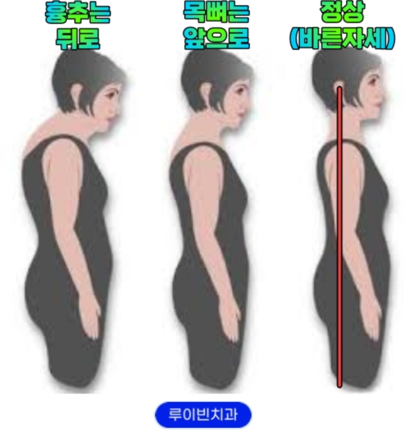 뒷머리찌릿 귀뒤통증왼쪽 오른쪽 아플때 네이버 블로그