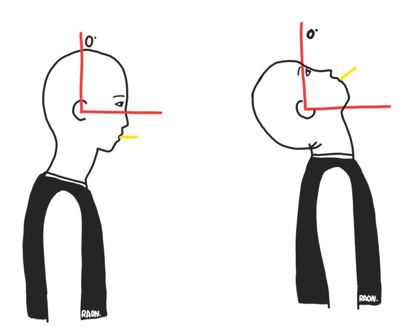 ROM 관절가동범위 평가 : 목 관절 (neck/cervical) : 네이버 블로그