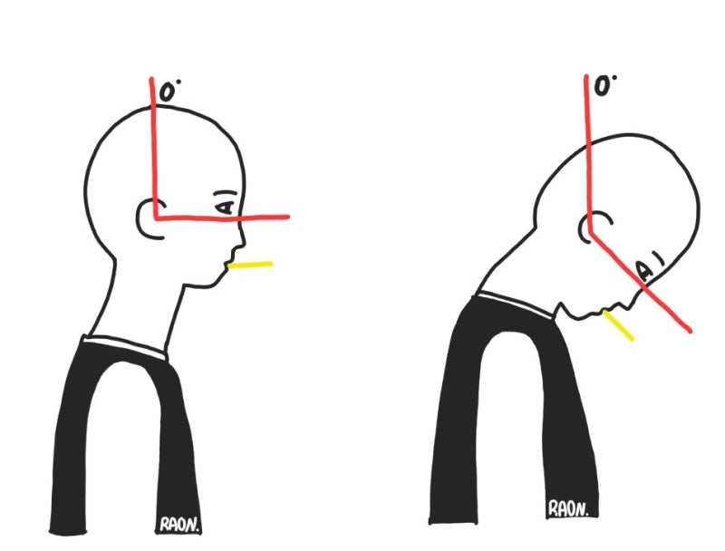 ROM 관절가동범위 평가 : 목 관절 (neck/cervical) : 네이버 블로그