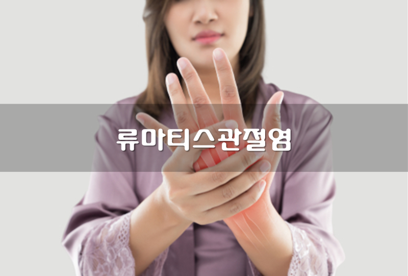 조인스 조인스정 골관절증 골관절염 류마티스관절염 병원 처방약 성분 효능 효과 복용법 부작용 주의사항 네이버 블로그