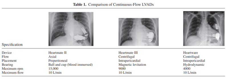 Heartmate 3 - LVAD, Left ventricular assist device 좌심실보조장치 : 네이버 블로그