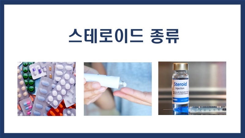스테로이드 코르티코스테로이드 아나볼릭 스테로이드 헬스 스테로이드 효과 부작용 주사 연고 먹는약 불법 술 네이버 블로그