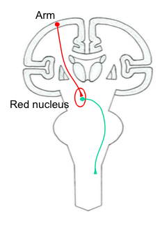 Decerebrate? Decorticate? (feat. 제뇌자세, 제피질자세) : 네이버 블로그