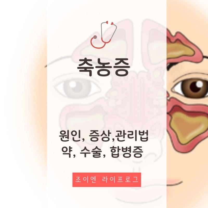 축농증 증상 원인 약 수술 관리법 부비동염 네이버 블로그