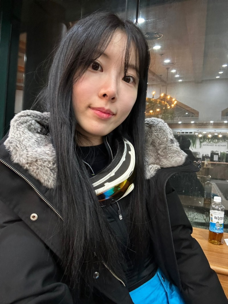 쥬베룩 볼륨 삼성 피부과 솔직 후기 전후붓기부작용효과 등 네이버 블로그