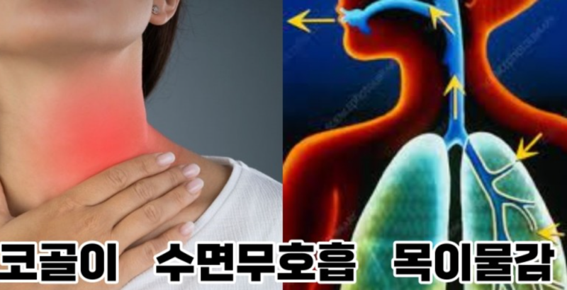 침샘비대증 귀밑 턱밑 부음 치료 네이버 블로그