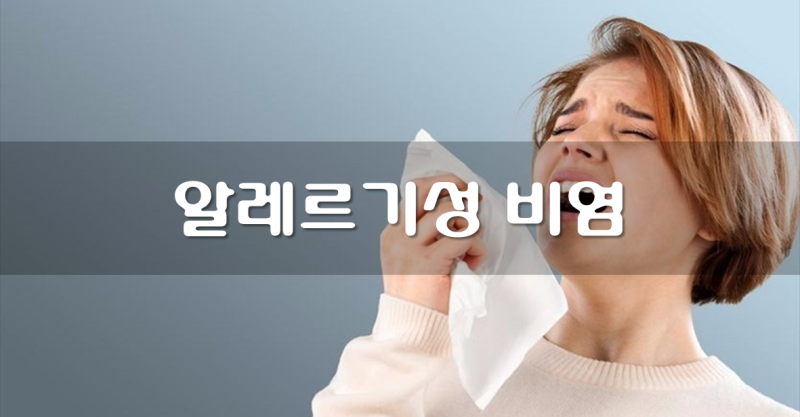 노텍 노텍정 알레르기비염 알레르기성 결막염 두드러기 가려움증 약국약 효능 효과 복용법 부작용 가격 네이버 블로그