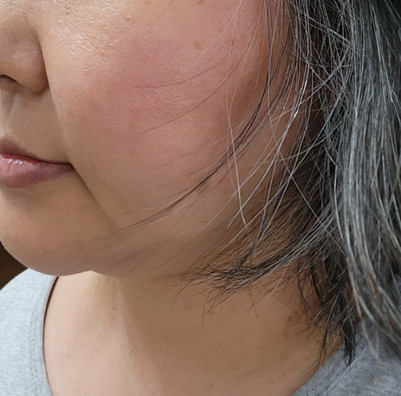 여성 갱년기 증상 극복 50대 영양제 루바브 뿌리 추출물 레드밸런스 네이버 블로그