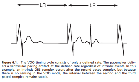 Temporary Pacemaker(TPM), 임시심박동기 : 네이버 블로그