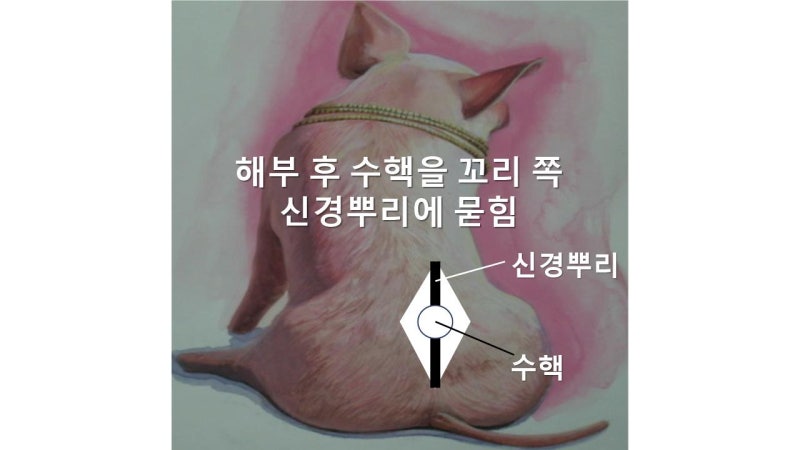 좌골신경통sciatica 통증 원인 증상 및 비 수술적 치료 방법약 주사 자세 운동 네이버 블로그