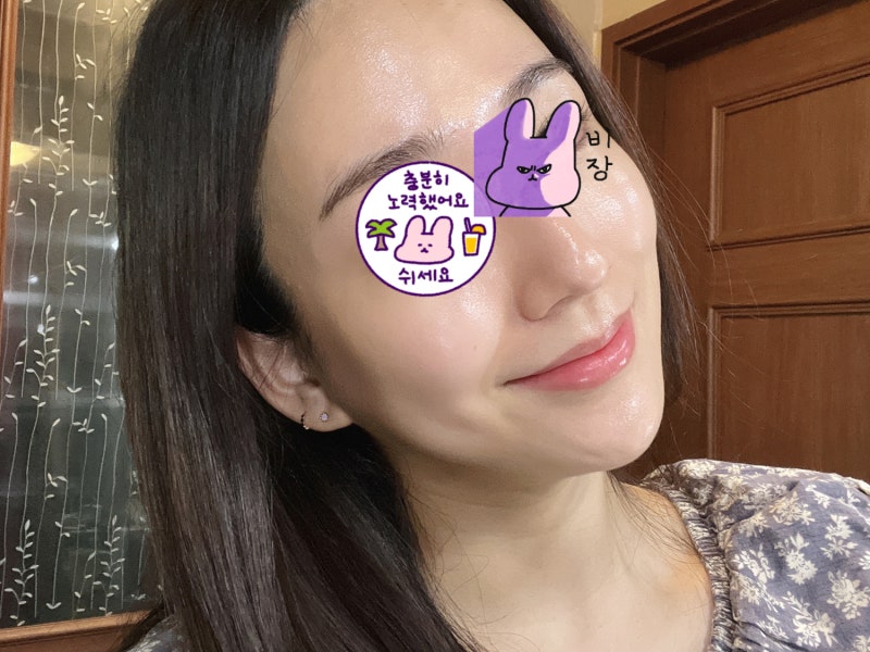 에스트라 아토베리어 크림 Md 5통 사용 후기 아토베리어 365라인 차이 의료기기민감성피부내돈내산 네이버 블로그