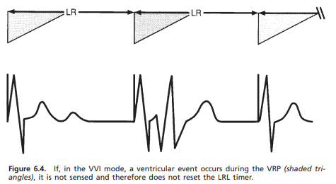 Temporary Pacemaker(TPM), 임시심박동기 : 네이버 블로그