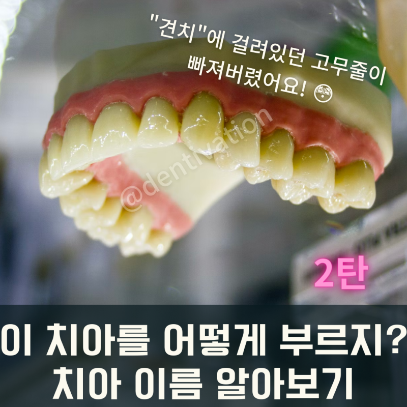 소구치 견치 치아이름 한글 치아이름 영어로 알아보기 치과용어 치과상식 네이버 블로그