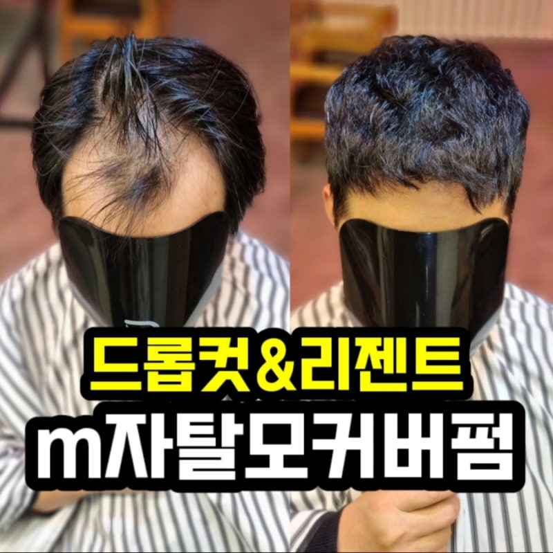 탈모미용실 남자탈모펌 탈모드롭컷 M자탈모머리스타일 M자탈모헤어스타일 탈모펌 머리숱없는남자펌탈모커버펌 남자탈모 M자탈모 정수리탈모