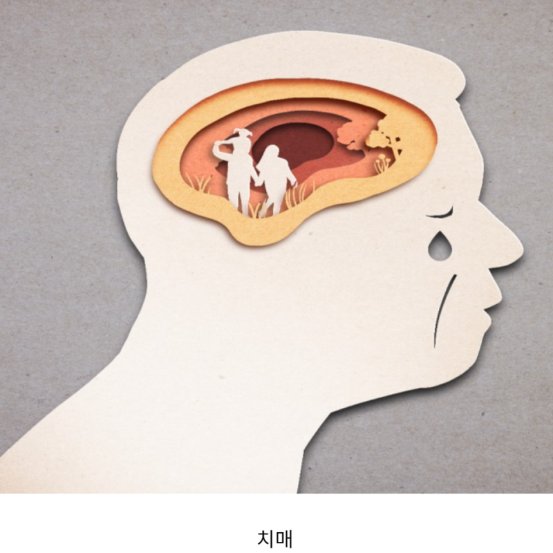 뇌영양제 포스파티딜세린 효능 부작용 알아보고 치매영양제로 관리 네이버 블로그