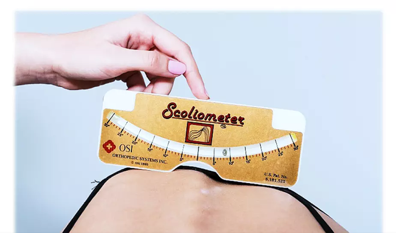 척추측만증(Scoliosis) 검사 및 교정(운동, 보조기) 방법 : 네이버 블로그