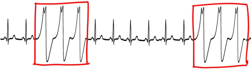 VPC EKG 모니터링 하는 법 : 네이버 블로그