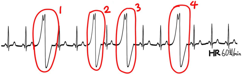 VPC EKG 모니터링 하는 법 : 네이버 블로그