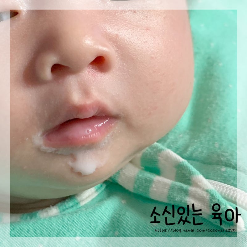 아기 신생아 분수토 원인 게워냄 구토 유문협착증 네이버 블로그