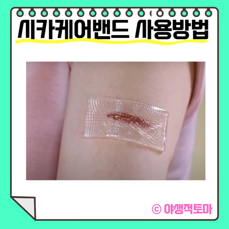 흉터관리 스테리스트립 Vs 시카케어 밴드 성분 작용기전 용도 특장점 조합 순서 네이버 블로그