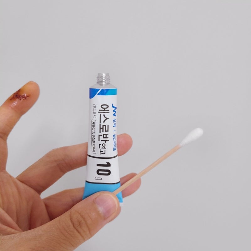 손가락 봉합수술 실밥 제거 리뷰 3탄 손가락 베였을 때 꿰맴 손베임 신경통증 흉터 에스로반연고 네이버 블로그
