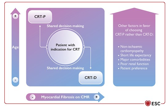 CRT : Cardiac Resynchronization therapy 심장 재동기화 치료 - 원리, 목적, 적응증 : 네이버 블로그