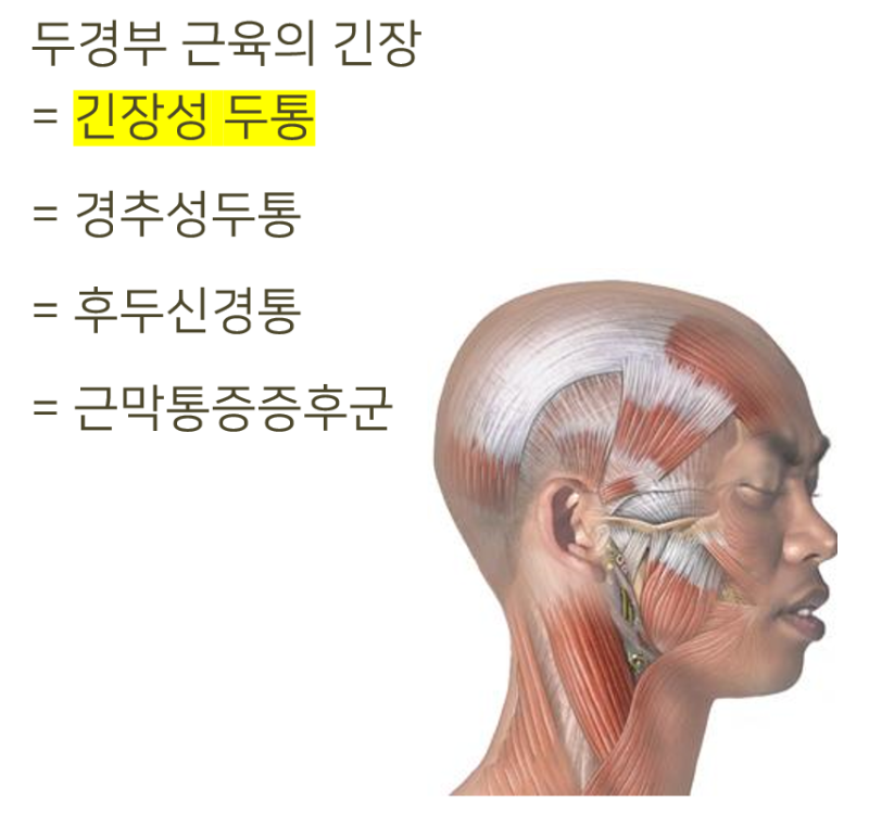 부산두통 긴장성 두통에 대한 신경과 의사의 조언 네이버 블로그