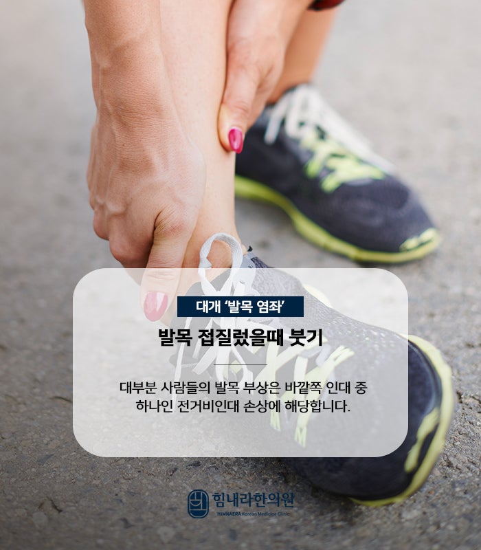 발목 접질렀을때 붓기 통증이 있다면 네이버 블로그