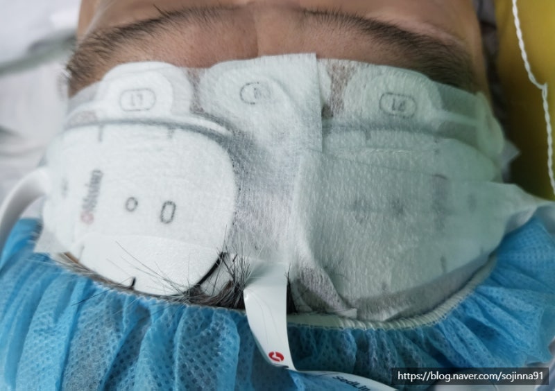 마취 심도 모니터링 : Sedline(Masimo)에 관하여(SEF, suppression ratio, DSA, EMG ...