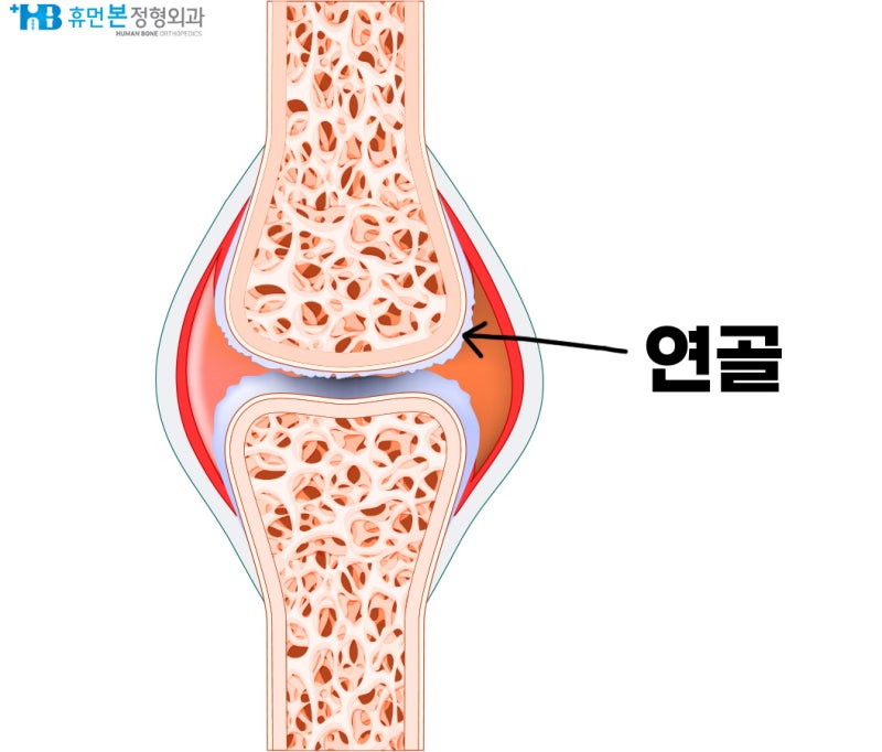 무릎 연골주사 효과부작용 횟수간격3회 효과 가격 실비의료보험 네이버 블로그
