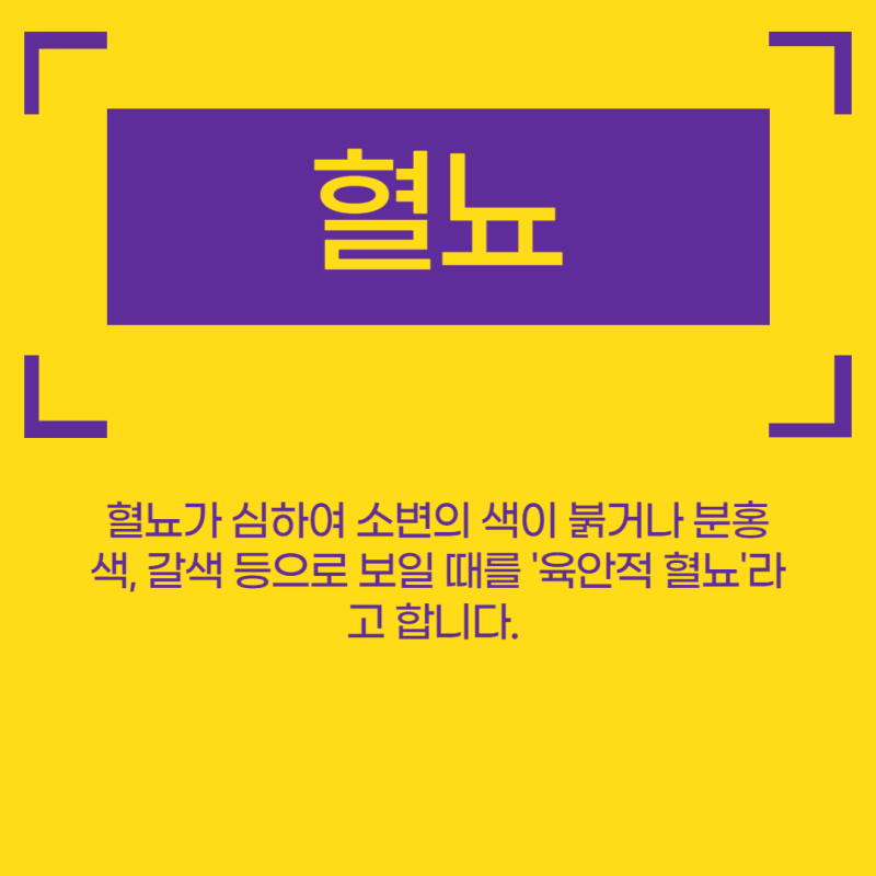 소변에 피가 나오는 혈뇨 원인 질환과 검사 방법 네이버 블로그