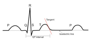 QT prolongation(긴 QT 증후군) 이 있는 경우 마취 시 선호, 조심해야 하는 약물. : 네이버 블로그