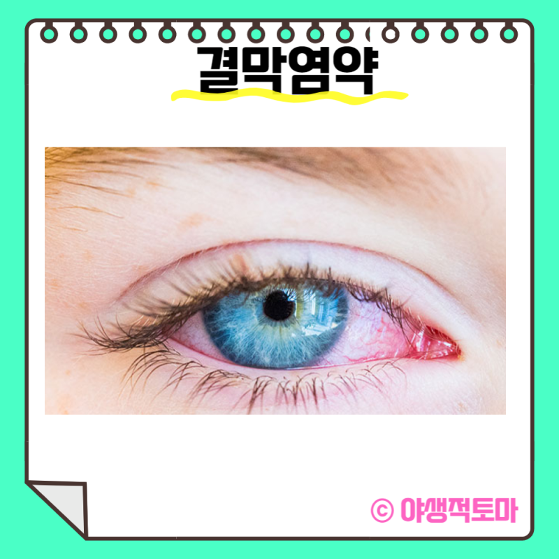 결막염약 테라마이신 안연고 Vs 나조린 성분 작용기전 효능 부작용 네이버 블로그