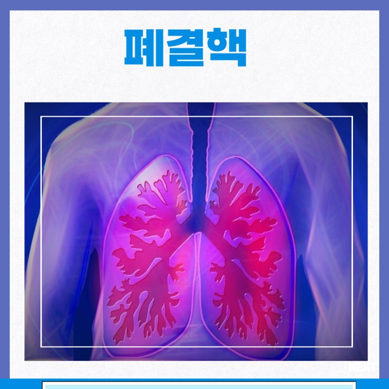 폐결핵 결핵 증상 원인 전염 치료 예방 네이버 블로그