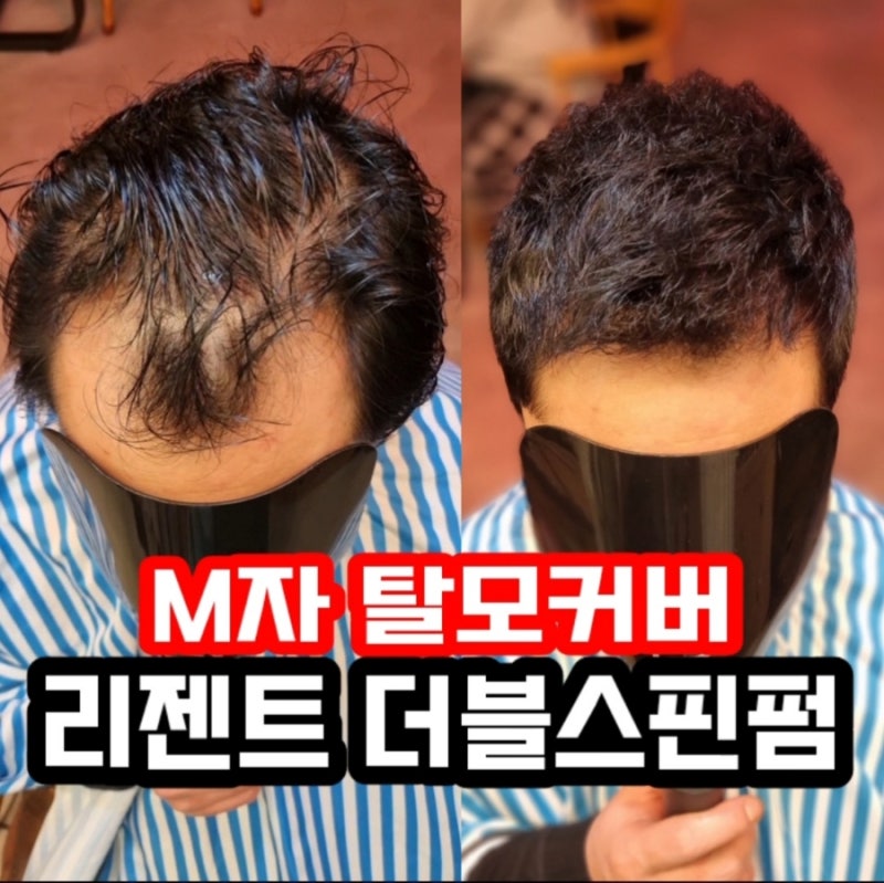 인천탈모펌 40대남자파마 30대남자머리 M자리젠트컷 M자탈모아이비리그컷 인천호일펌 인천탈모미용실 M탈모펌 M탈모파마 히든펌 남자
