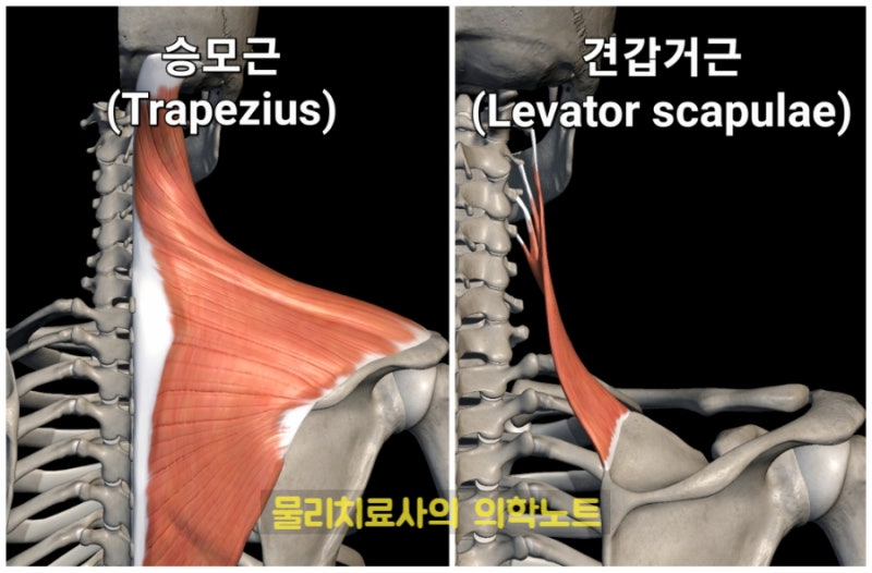 견갑골 내측 통증 원인 사각근scalene 긴장 견갑배신경 포착 증후군dorsal Scapular Nerve