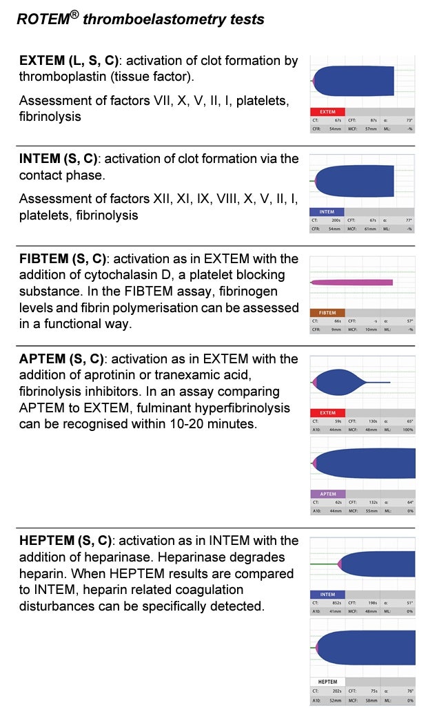 로템 델타(ROTEM® delta) 지혈분석기 : 네이버 블로그