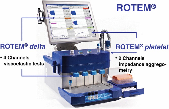 회전 혈전탄성측정법(ROTEM), 응고병증 지혈장애를 조기에 분석하는 유용한 검사법 : 네이버 블로그