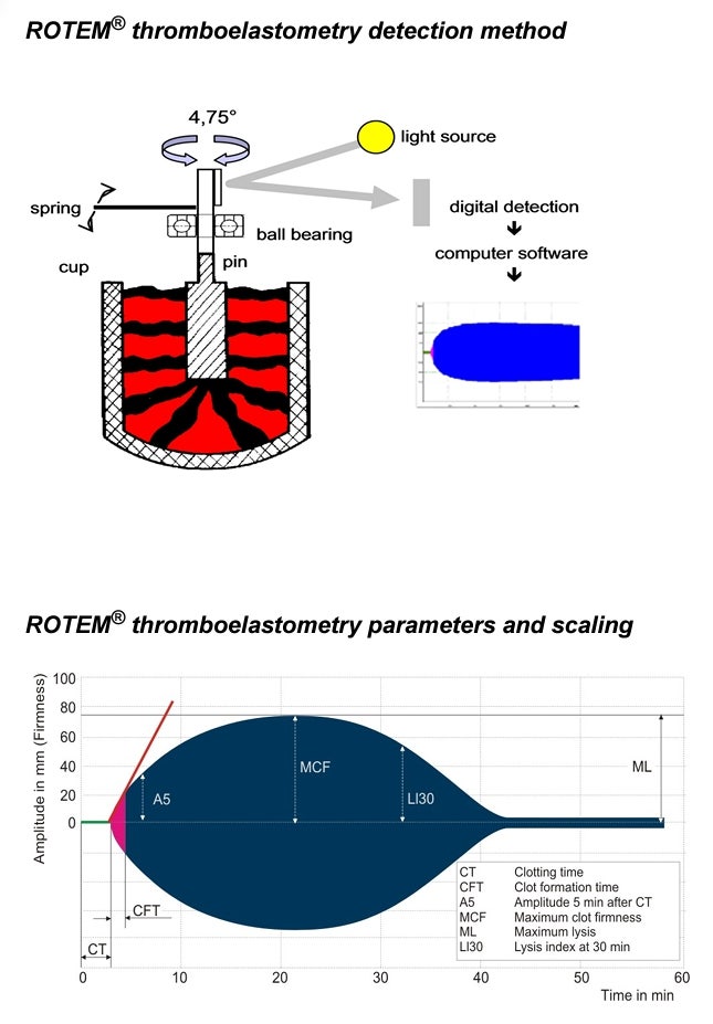 로템 델타(ROTEM® delta) 지혈분석기 : 네이버 블로그