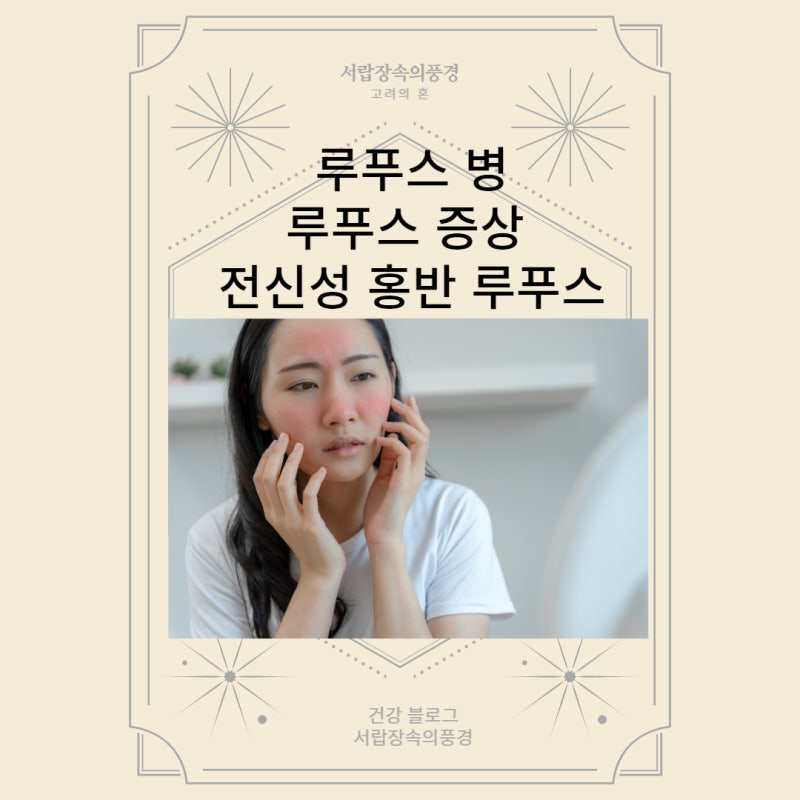 루푸스병 루푸스 증상 원인 검사 전신성 홍반루푸스 치료 진단 완치는 어려운 루푸스 네이버 블로그
