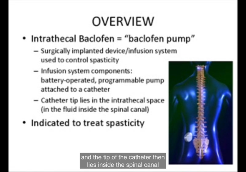 Baclofen 바클로펜 Intrathecal pump 척수강내 약물주입펌프 공부하기 : 네이버 블로그
