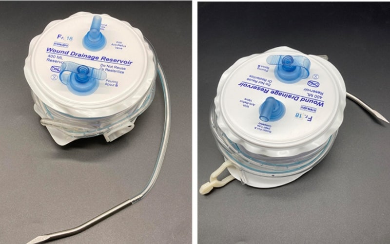 수술실스크럽 기본 - 배액관 종류 Drain- HemoVac, Borovac SS100L /SS100L+/ SS100JP ...