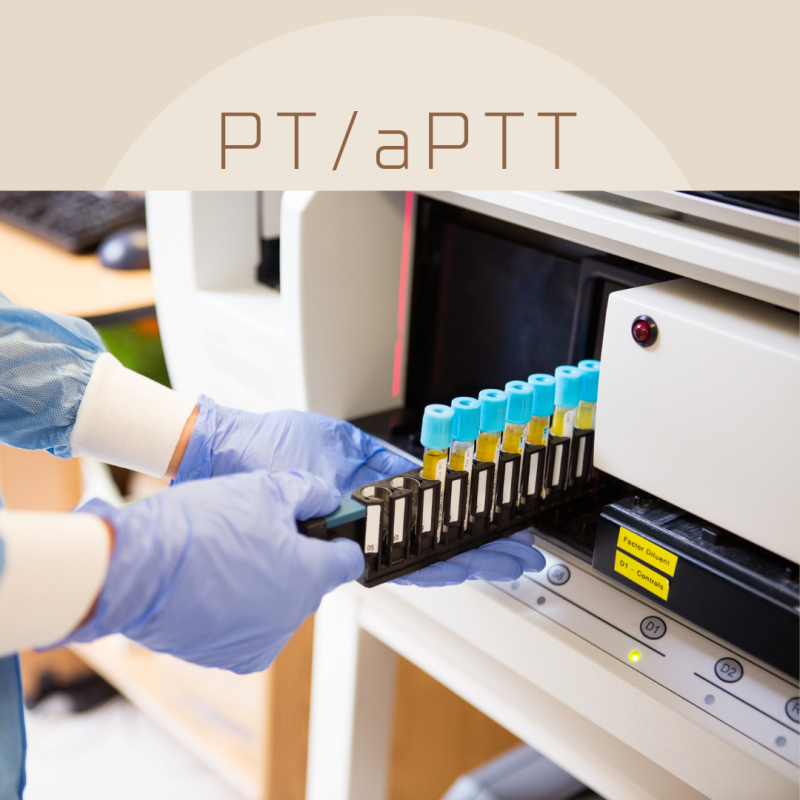 혈액응고검사 PT aPTT 알아두면 유용한 정상 수치 : 네이버 블로그