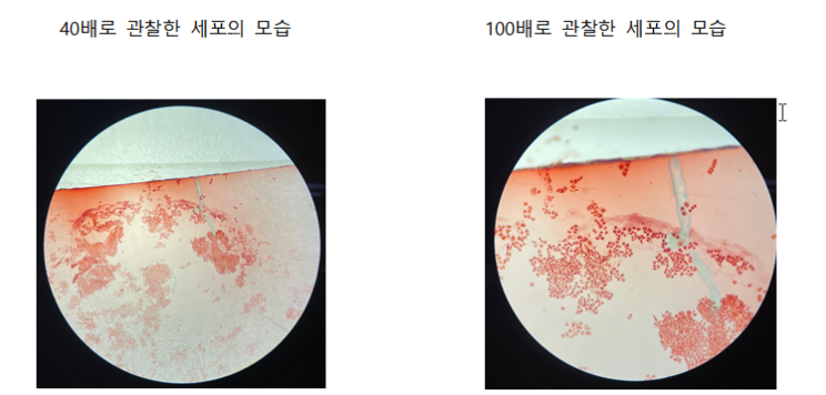 일반생물학 및 실험1 체세포 분열 관찰 네이버 블로그