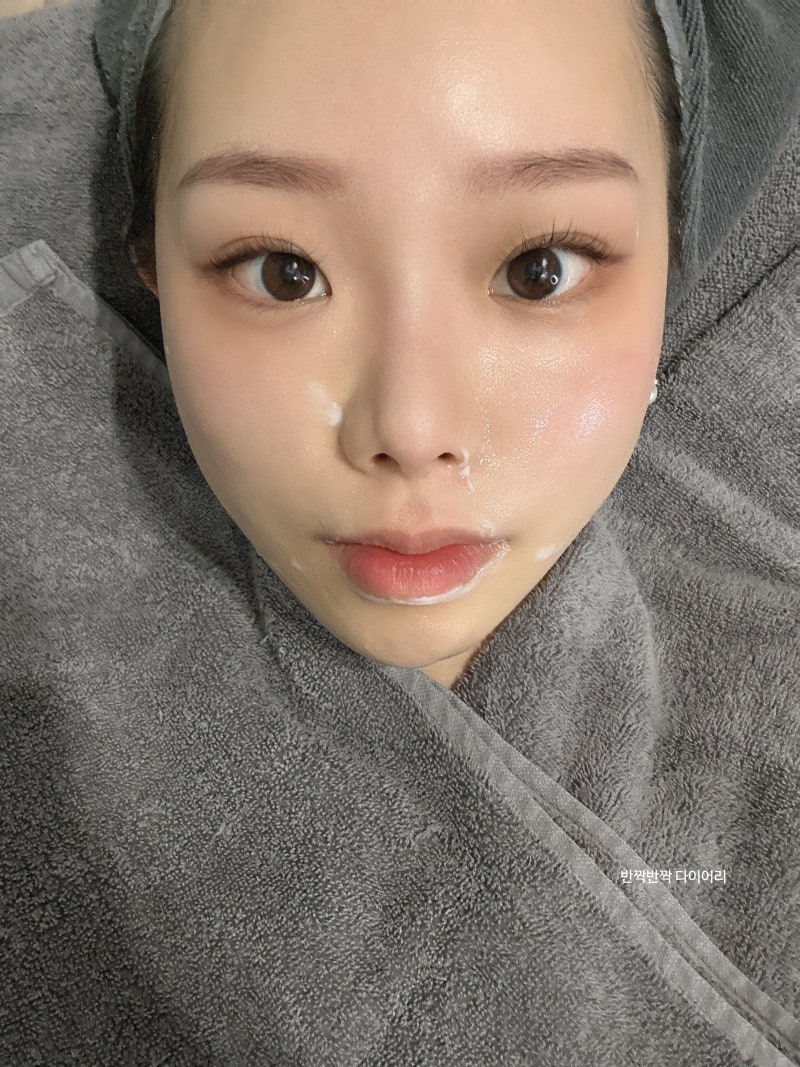 청담 피부과 올리지오 리프팅 시술 한 달 후기 가격 효과 부작용 네이버 블로그